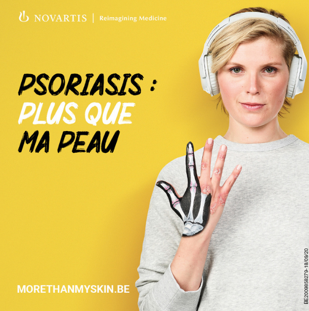 LE PSORIASIS, C ‘EST PLUS QU ‘UNE MALADIE DE LA PEAU – Psoriasis ...